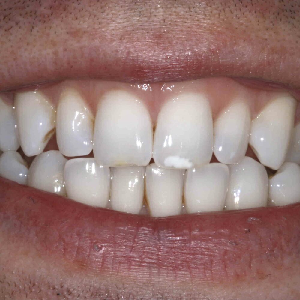 Gallery – Holland Park Dental